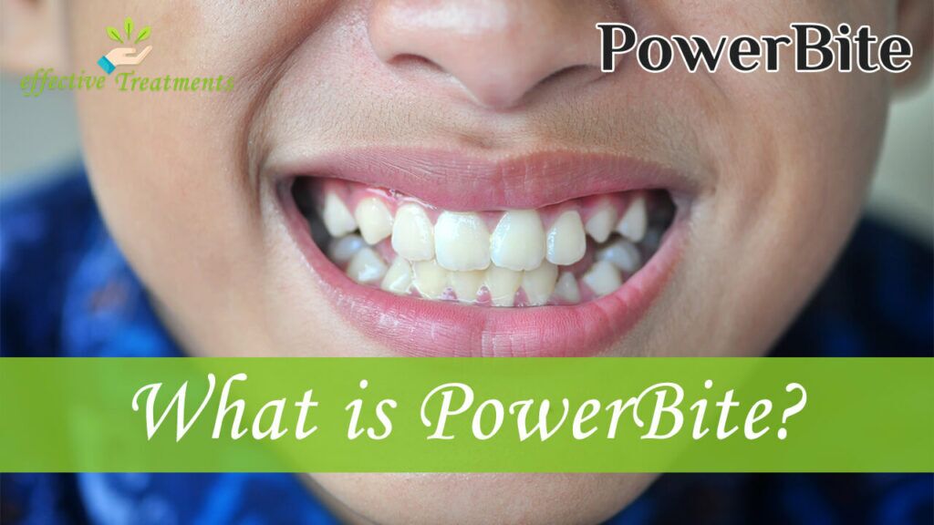 PowerBite Review [The Truth of Jim Grant Mineral Candy]